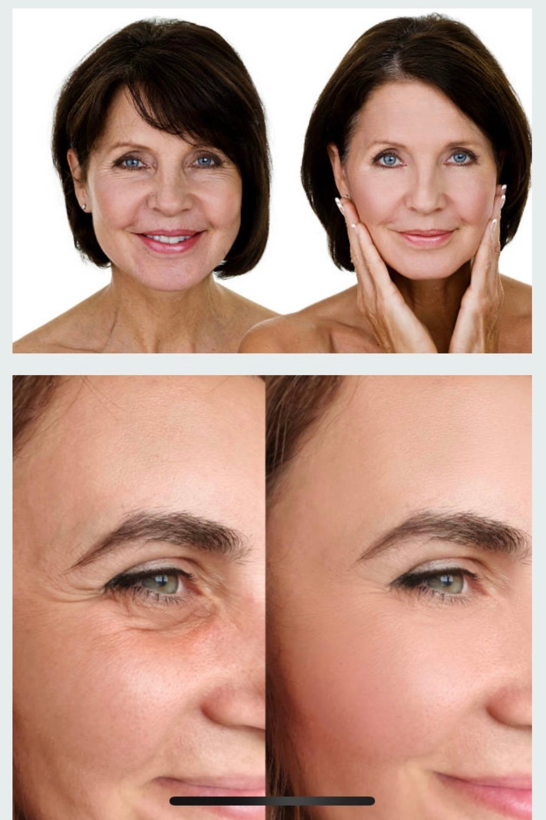 Botox And Fillers Your Pathway To A Refreshed And Youthful Appearance At