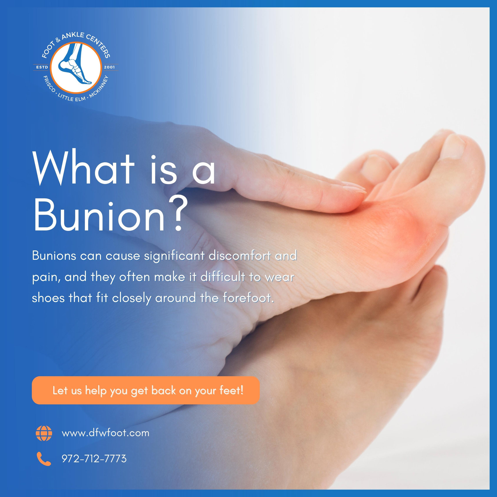 What is a Bunion? - Foot & Ankle Centers of Frisco and Plano